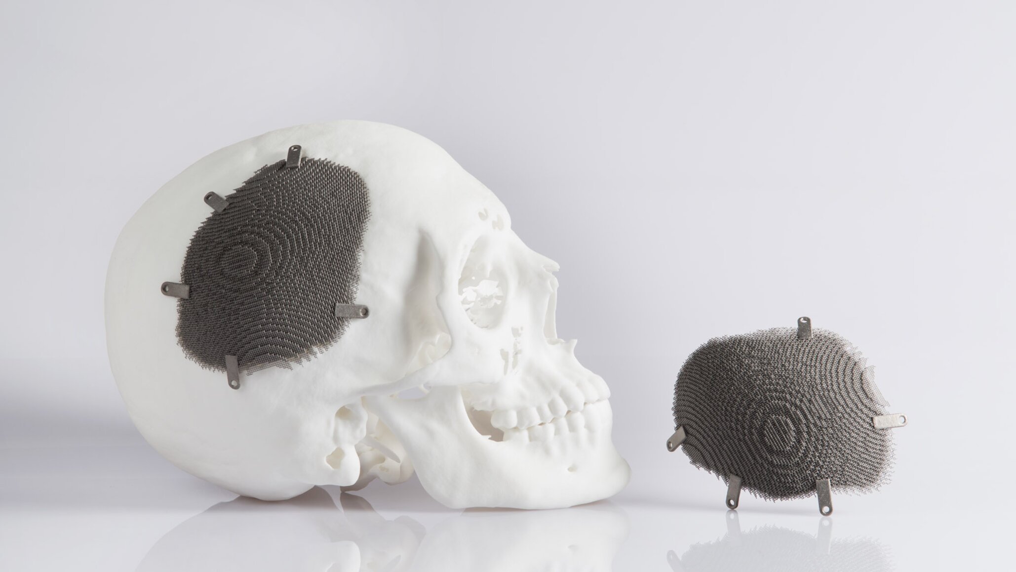 3d printing Applications for the medical industry | EOS GmbH