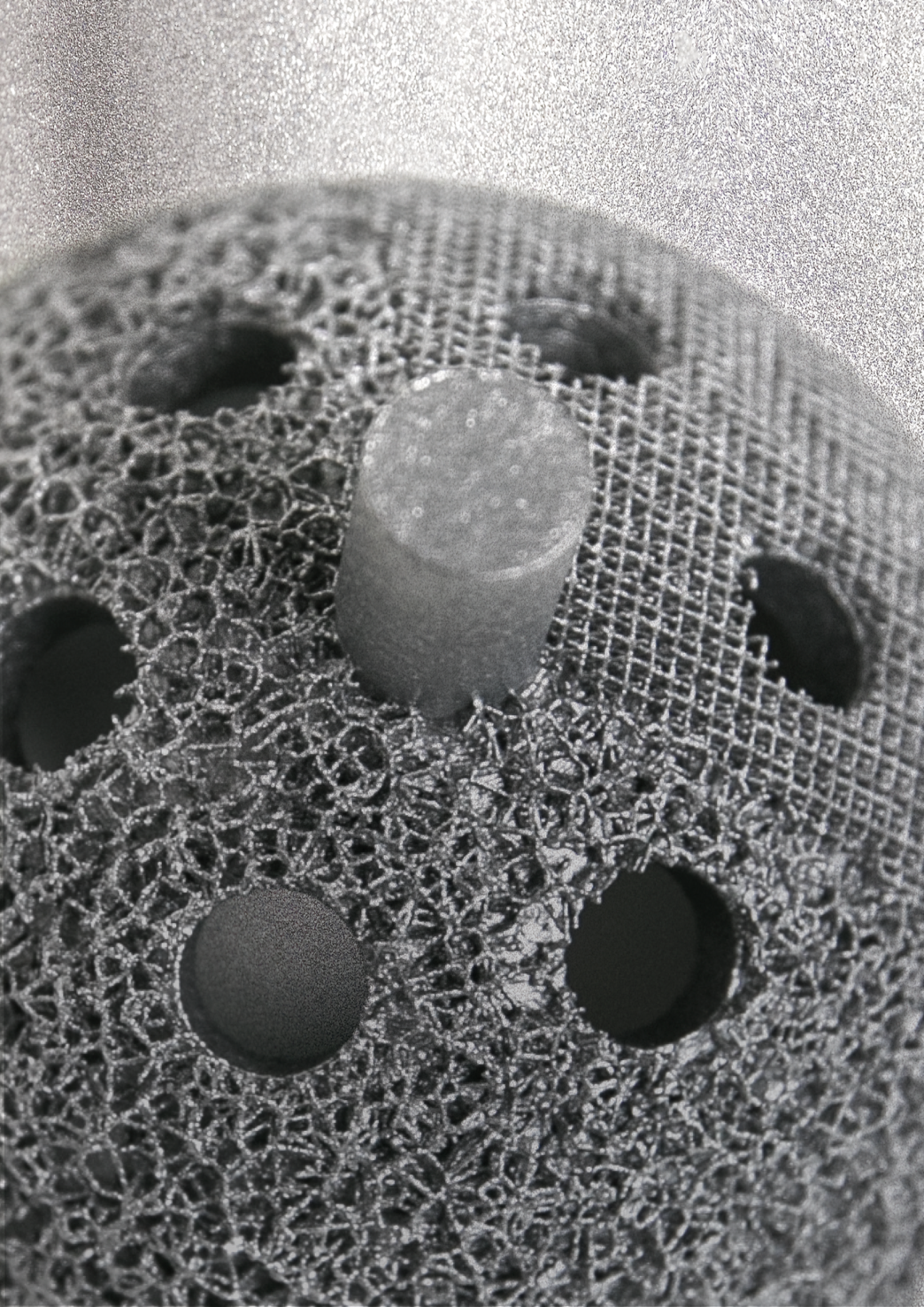 EOS Team Member Receives 3D Printed Bone-Growth Geometry in Double Hip ...