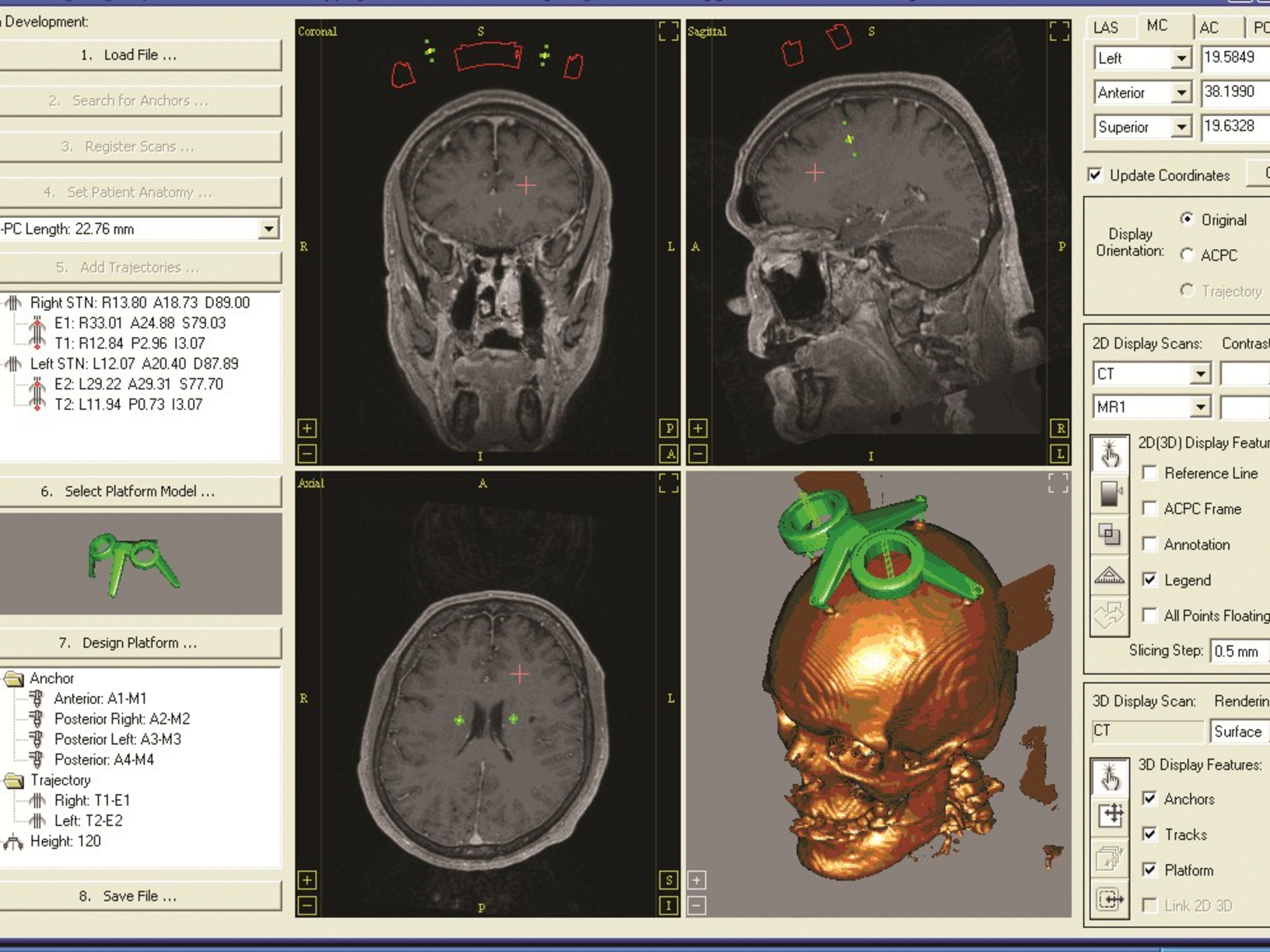 FHC - 医療機器向けアディティブ・マニュファクチャリング｜EOS GmbH