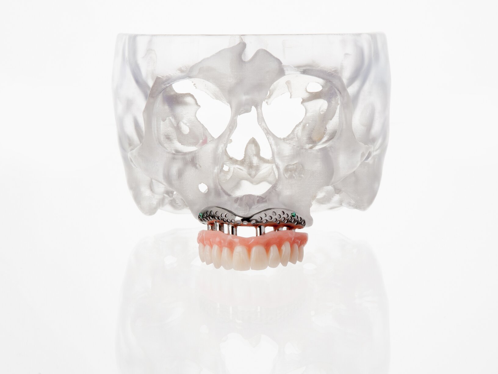 Solución OMX: impresión 3D para cirugía craneomaxilofacial EOS GmbH